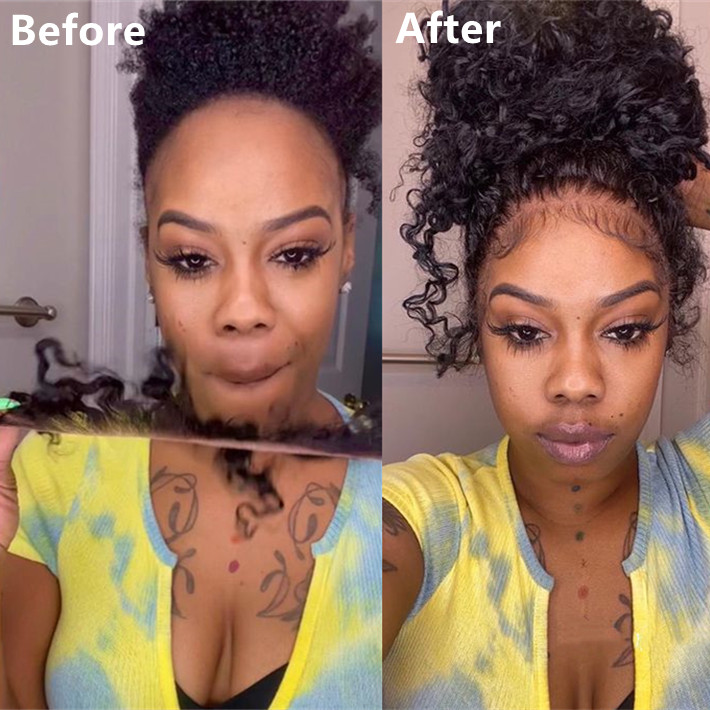 What is a lace strip? Advantage and disadvantage of B.A.P.S. Lace ...